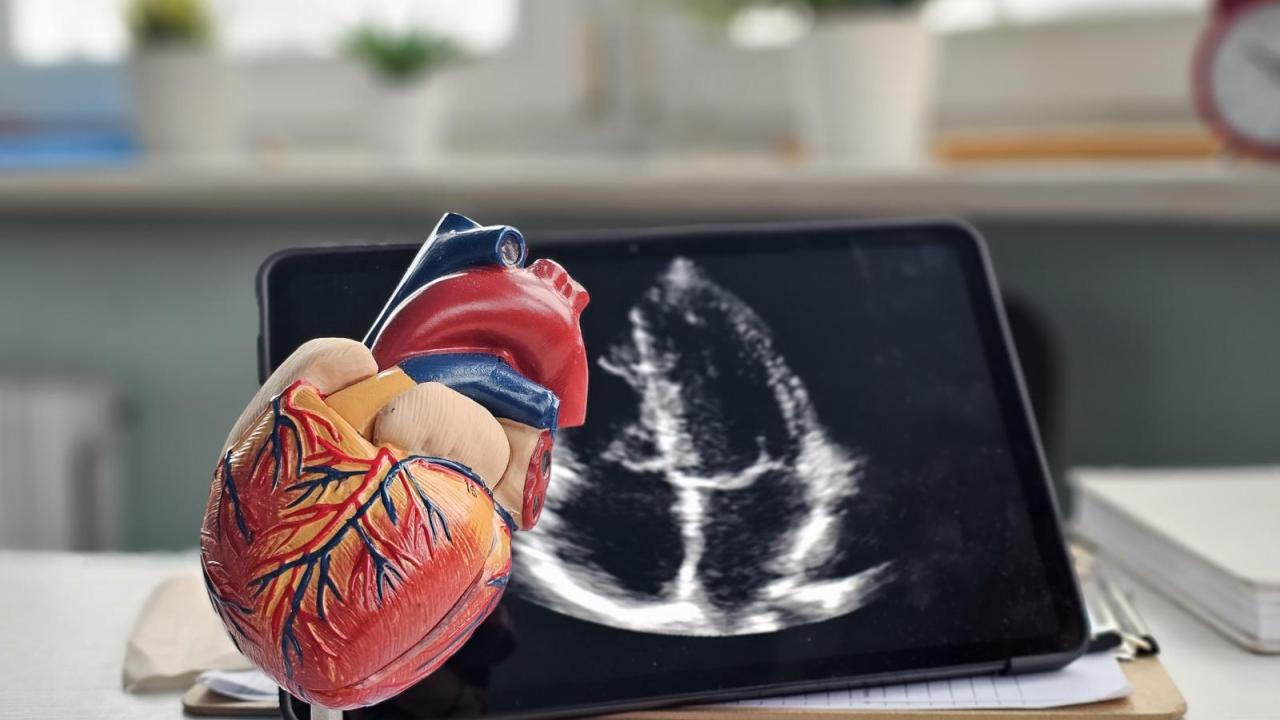 Angina with Non-Obstructive Coronary Arteries (ANOCA) Program ...
