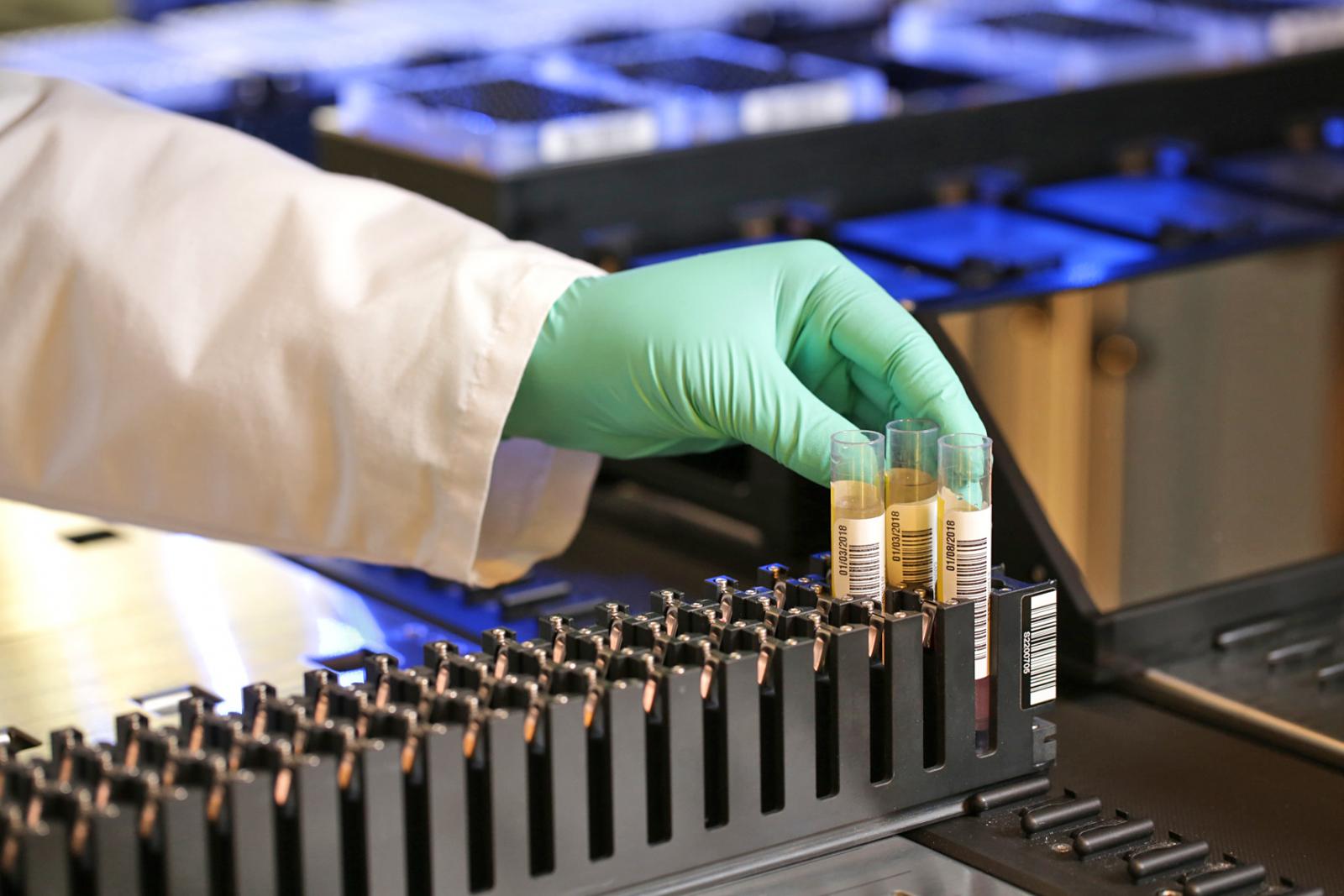 Bioinformatics and Genomics | Division of Cardiology